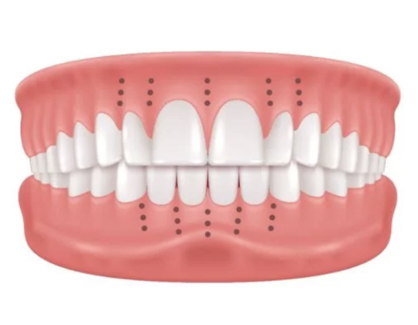 Accelerated Orthodontics: A Faster Way to Straighten Teeth